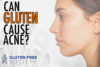 Can Gluten Cause Acne? - Gluten Free Society