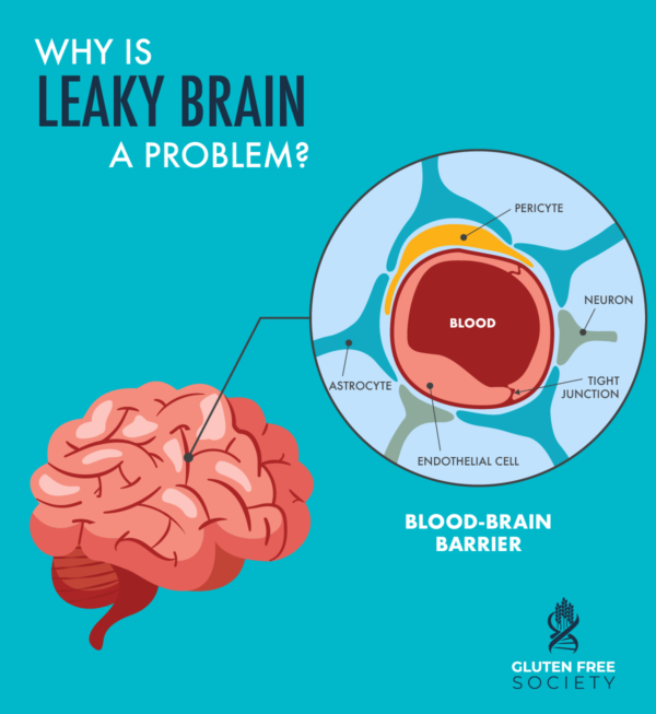 Is Leaky Brain a Gluten Problem? - Gluten Free Society