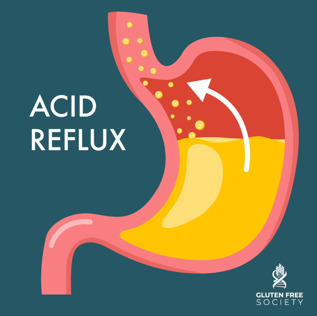 Acid Reflux Linked to Gluten Intolerance l Gluten Free Society