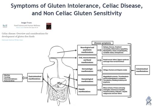 What Are The Symptoms of Gluten Intolerance? - Gluten Free Society