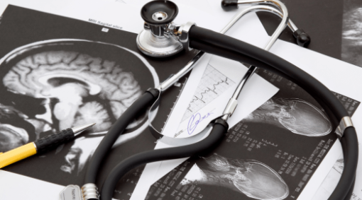 Gluten Protein Alters Brain Prolactin - Gluten Free Society